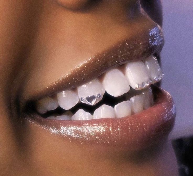 Strass – Urban Grillz